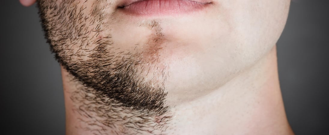 National No Beard Day (October 18th) | Days Of The Year