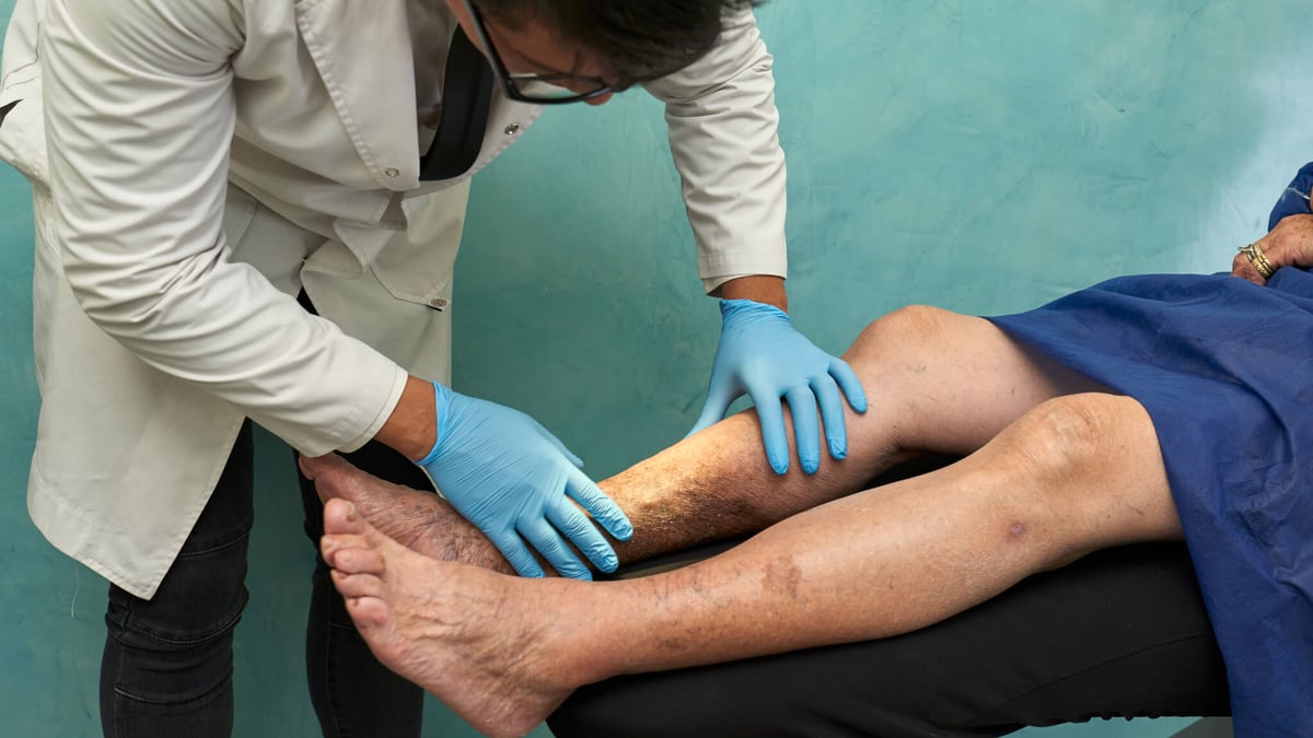 Vascular Disease Awareness Month (September 2024) | Days Of The Year