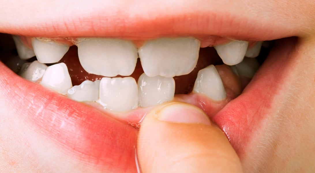 Global Scouse Day (February 28th) | Days Of The Year