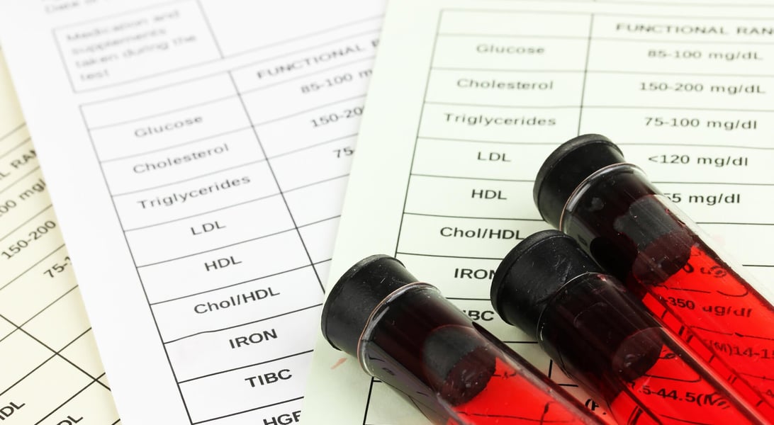 International Bat Appreciation Day (April 17th) | Days Of The Year