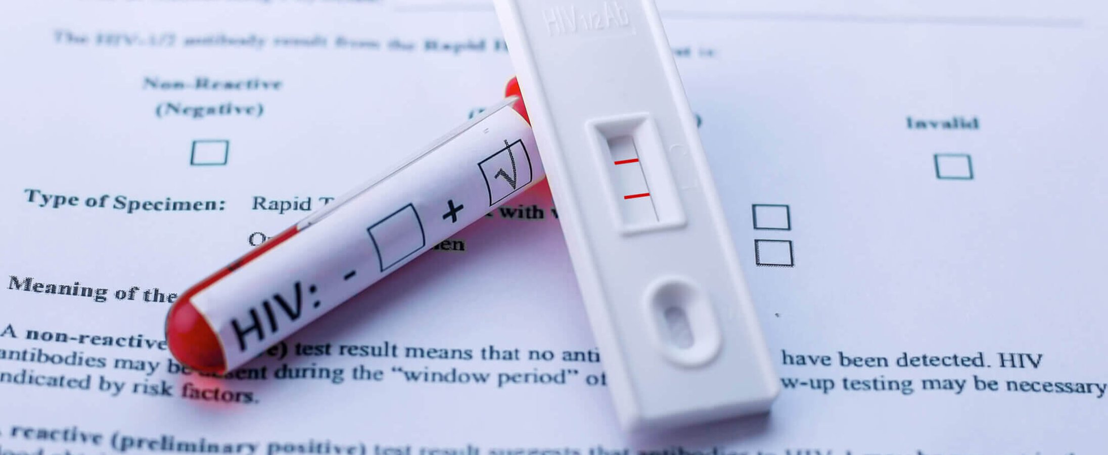 National HIV Testing Day (June 27th) | Days Of The Year