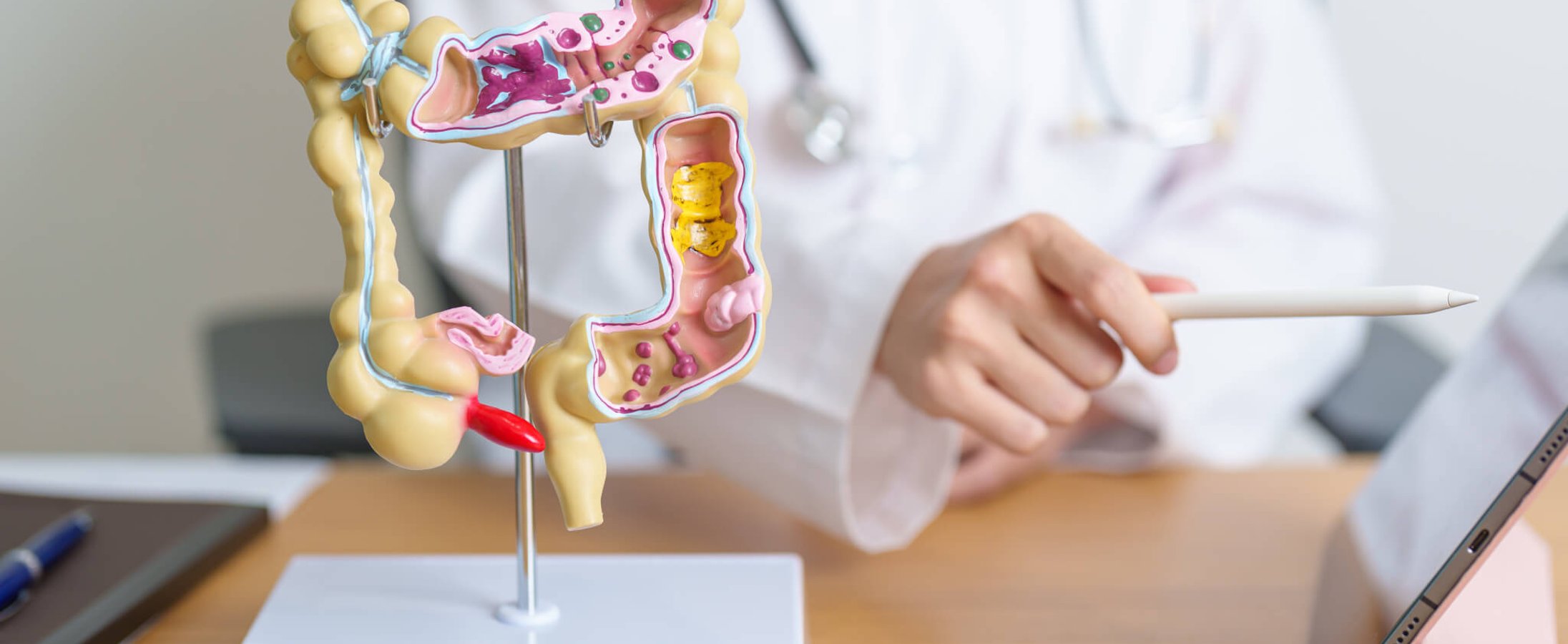 Step up for 30 For Bowel Cancer Month (April 2026) | Days Of The Year