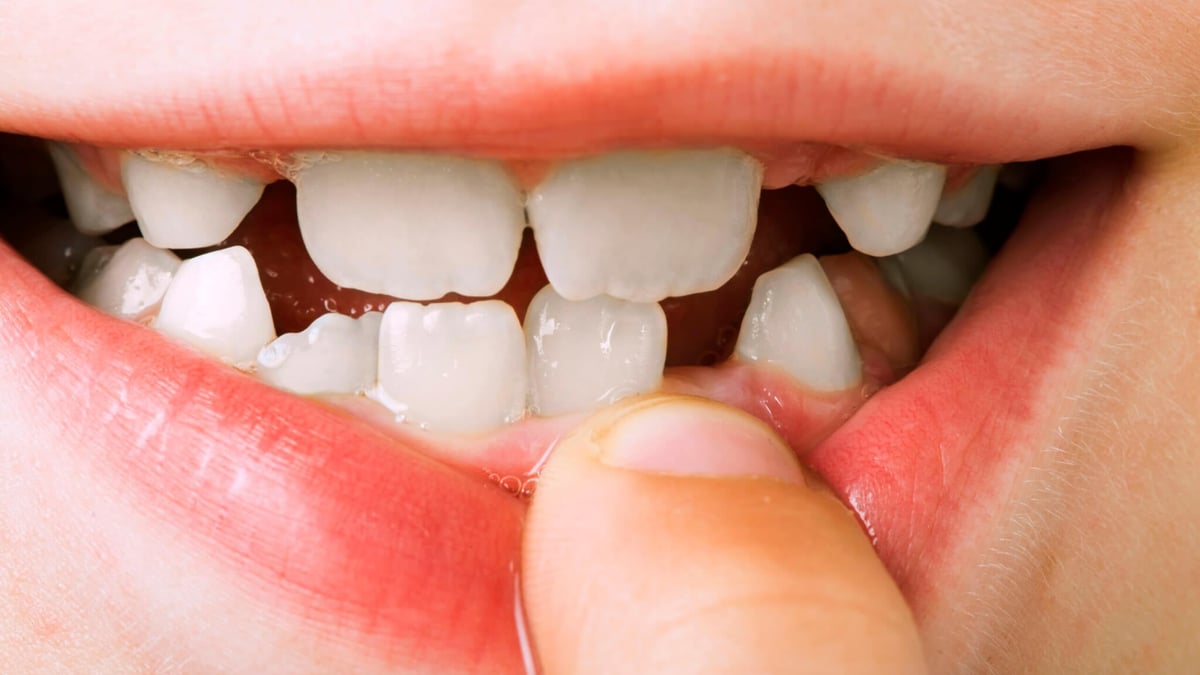 National Tooth Fairy Day (February 28th) | Days Of The Year